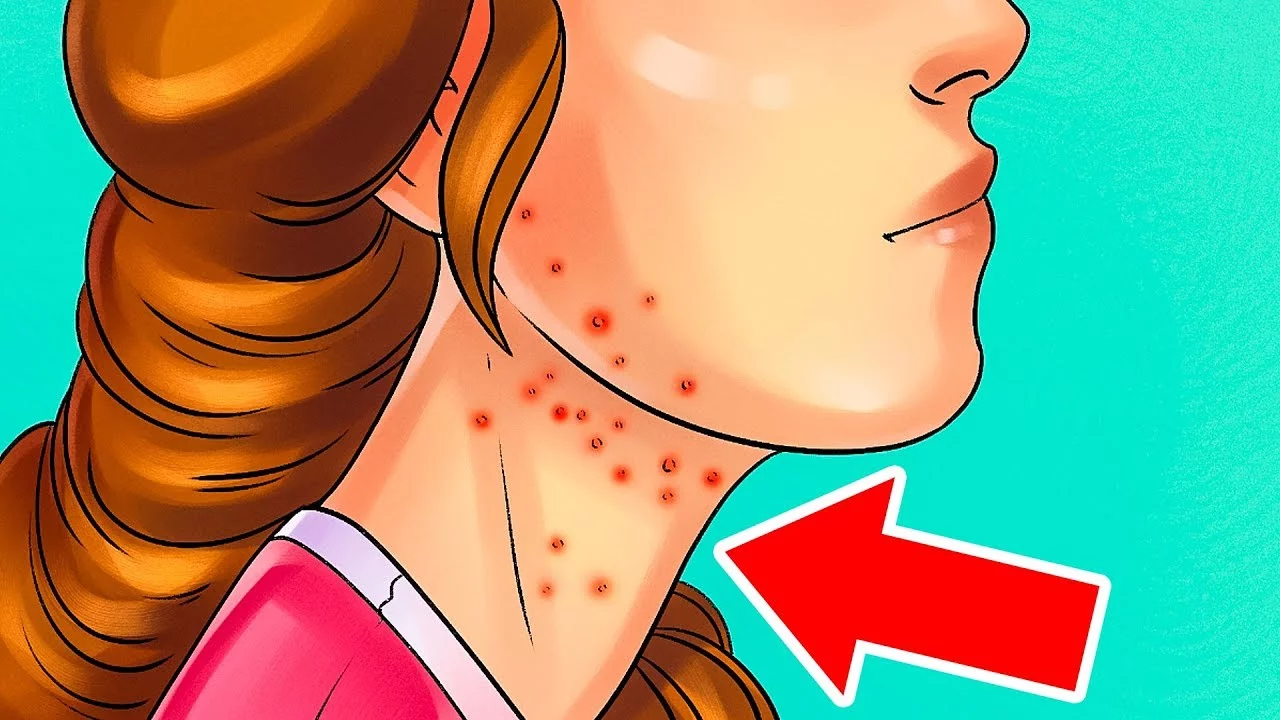 Decoding Sugar Overload: 10 Warning Signs Your Sweet Tooth Might Be ...