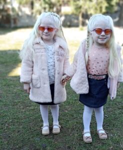 Unveiling the Extraordinary Journey of the First Albino Twins, a ...