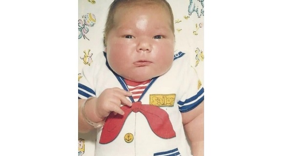 The Remarkable Journey of the 16-Pound Giant Baby of 1983 - The Best Media